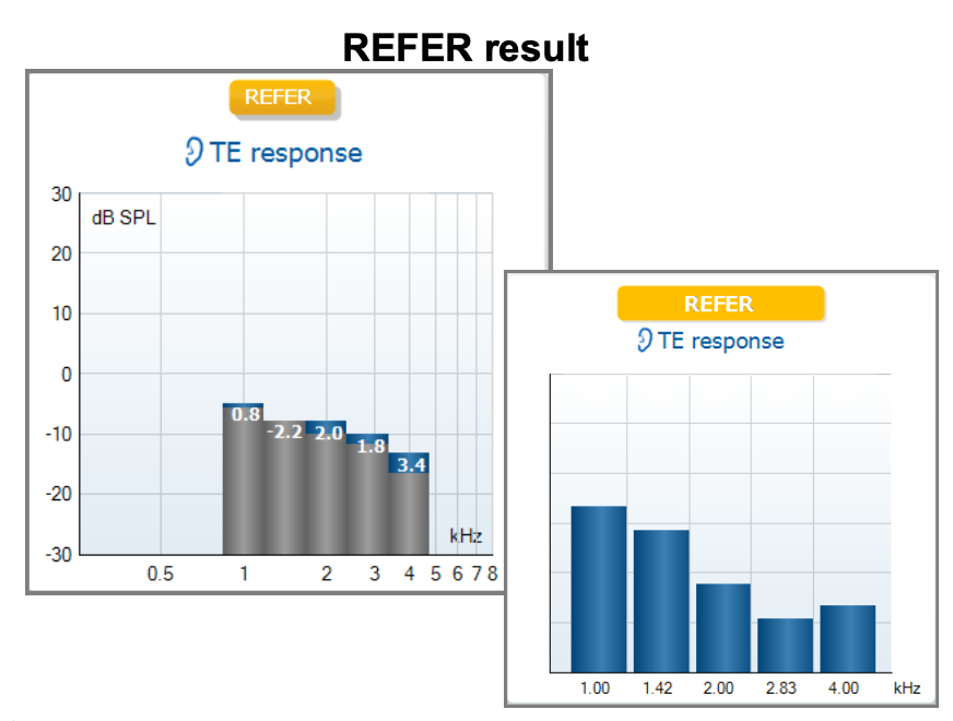 Titan | TEOAE PC | Interacoustics